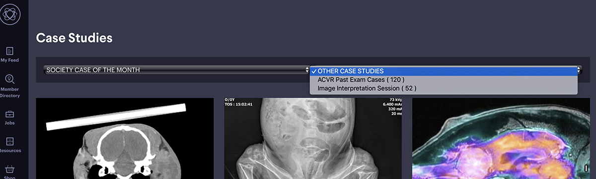 If you missed the Imaging Interpretation Session… | American College of ...